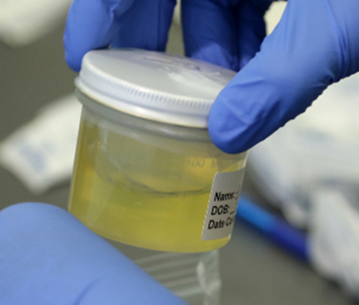 Testing for Urinary Tract Infections | XGene Diagnostics