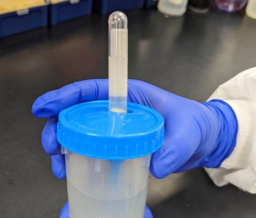 Testing for Urinary Tract Infections | XGene Diagnostics